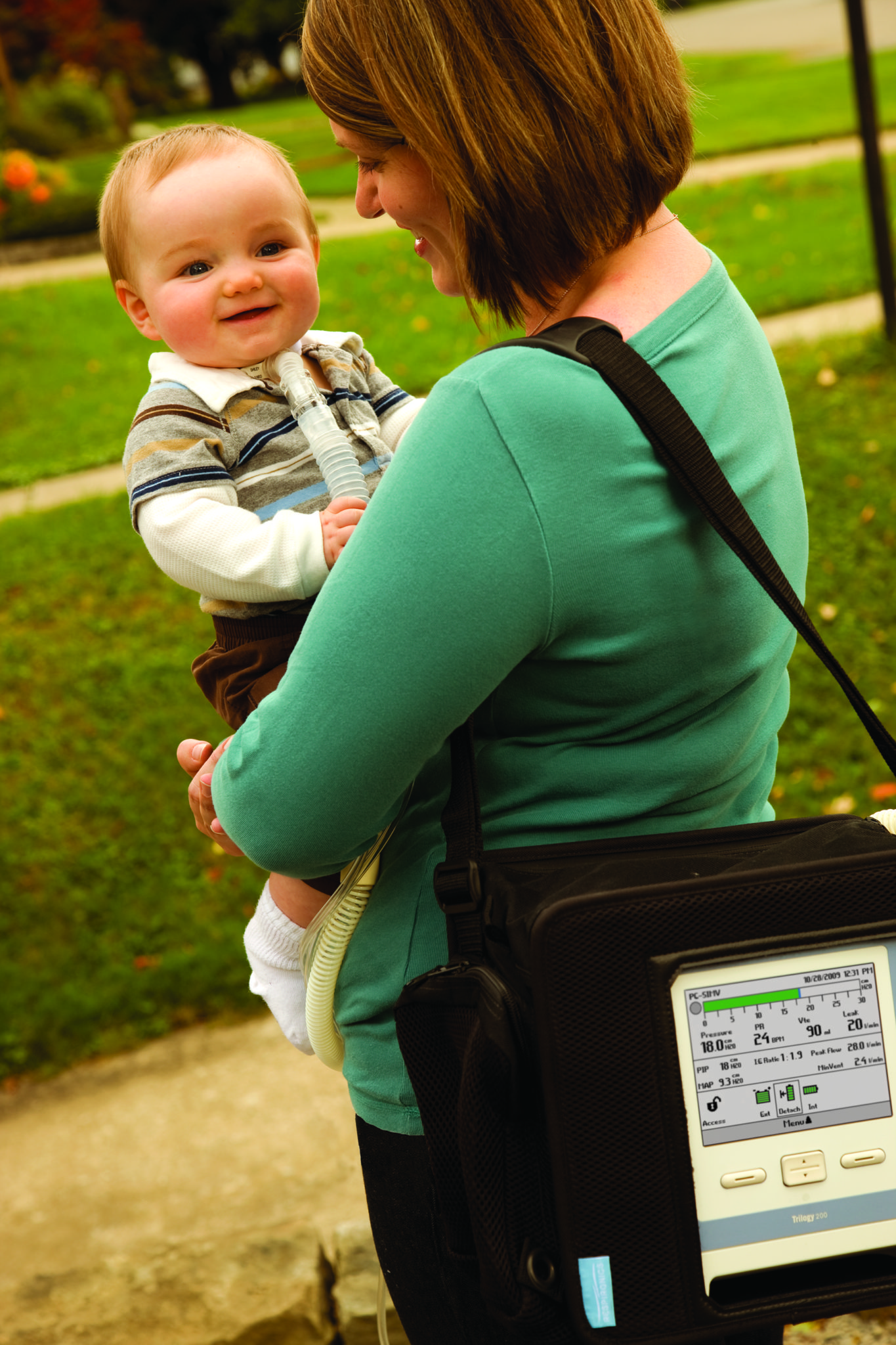 Philips Respironics Trilogy 200 Portable Ventilator – Compass Medical