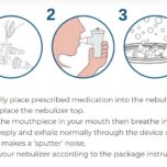Trudell Medical International AeroEclipse® II BAN™ Breath Actuated ...