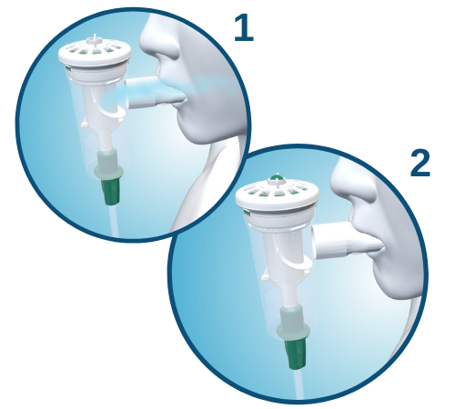 Trudell Medical International AeroEclipse® II BAN™ Breath Actuated ...